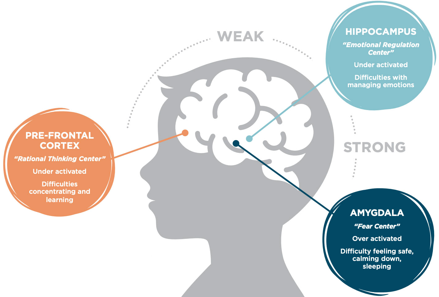 THE LIGHT: September 2024 - Childhood Trauma - Atlanta Mission